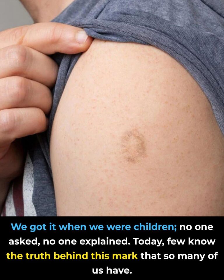 Here’s The Truth Behind This Scar On People’s Upper Left Arm – Best Recipes